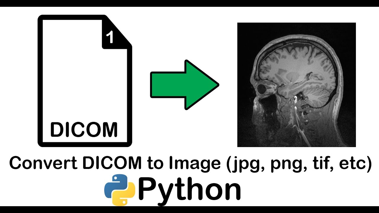 How to Convert Dicom to JPG using Python - Nucleio Information Services How to Convert Dicom to JPG using Python - Nucleio Information Services